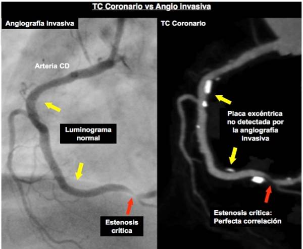 TC multicorte | Hospital Universitari Sagrat Cor - Grupo Quirónsalud